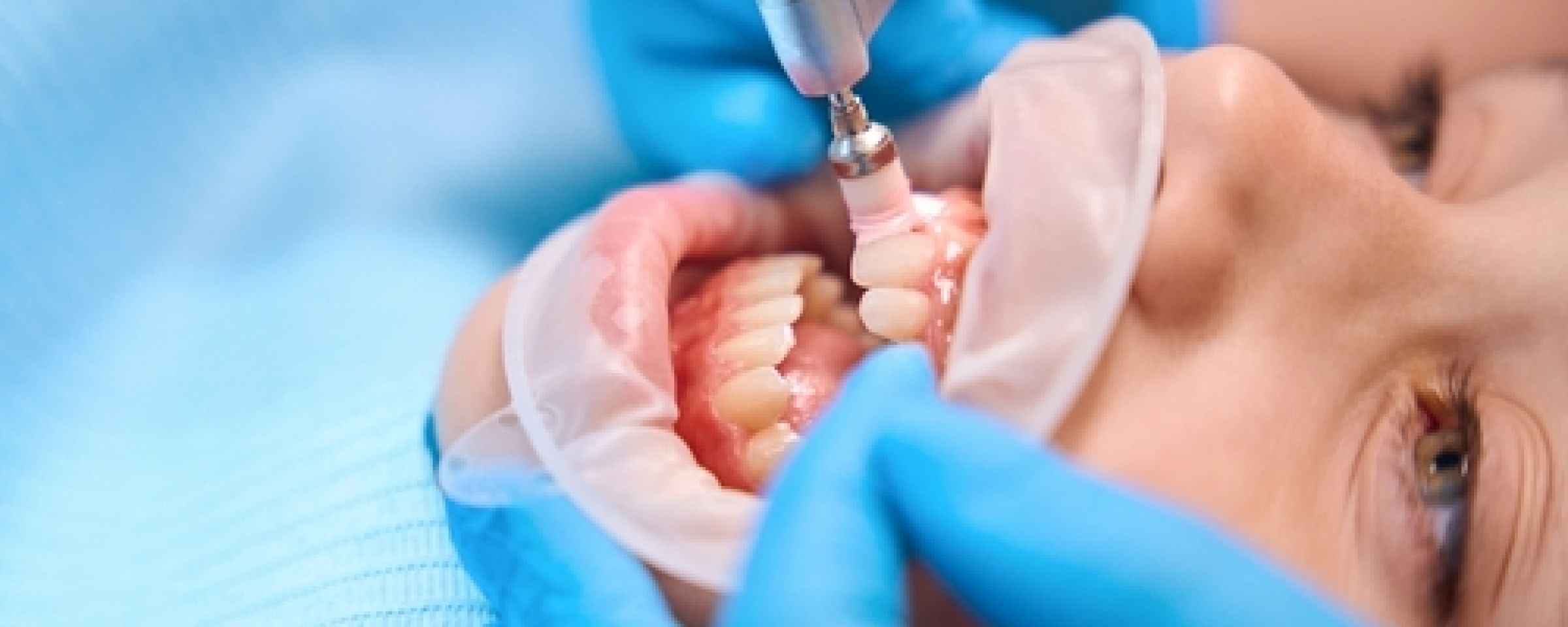 6 Effects Bulimia Has On Your Teeth | The Mayhill Dental and Specialist ...